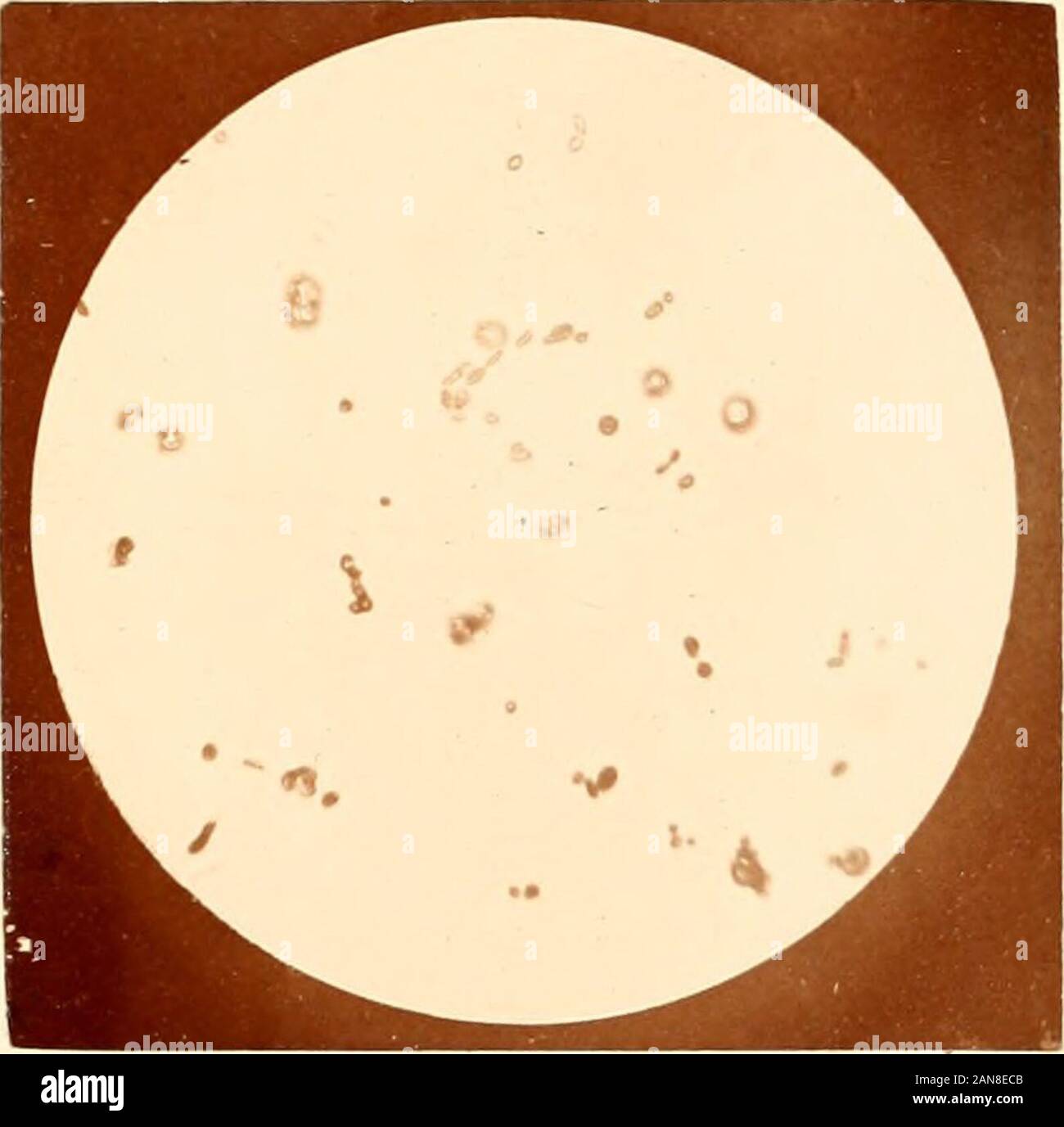 Iodine stained hi-res stock photography and images - Alamy