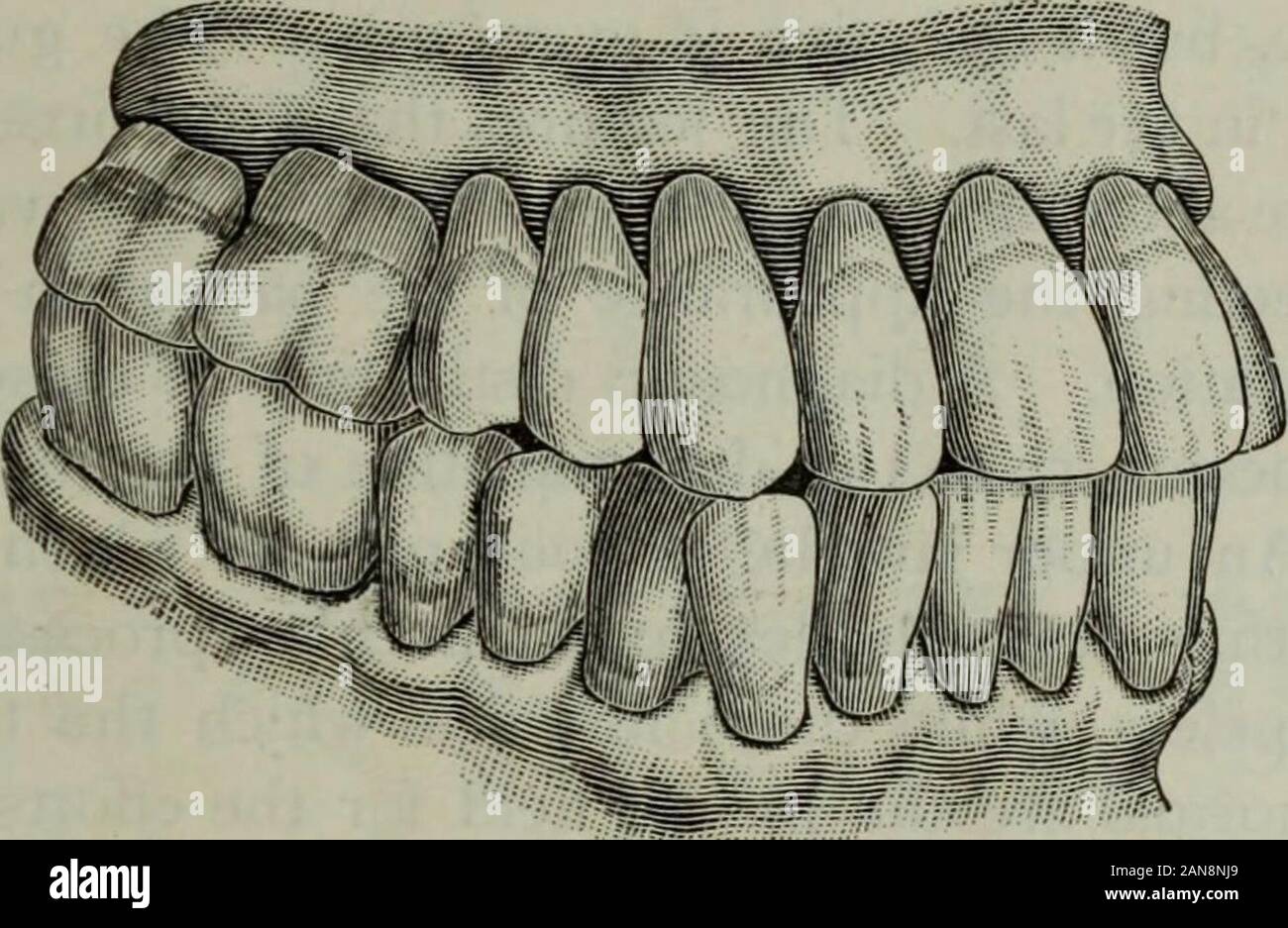 Posterior Anterior Teeth