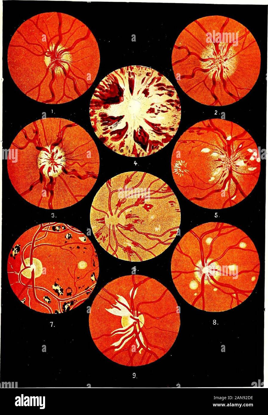 A treatise on diagnostic methods of examination . ent in simple ...