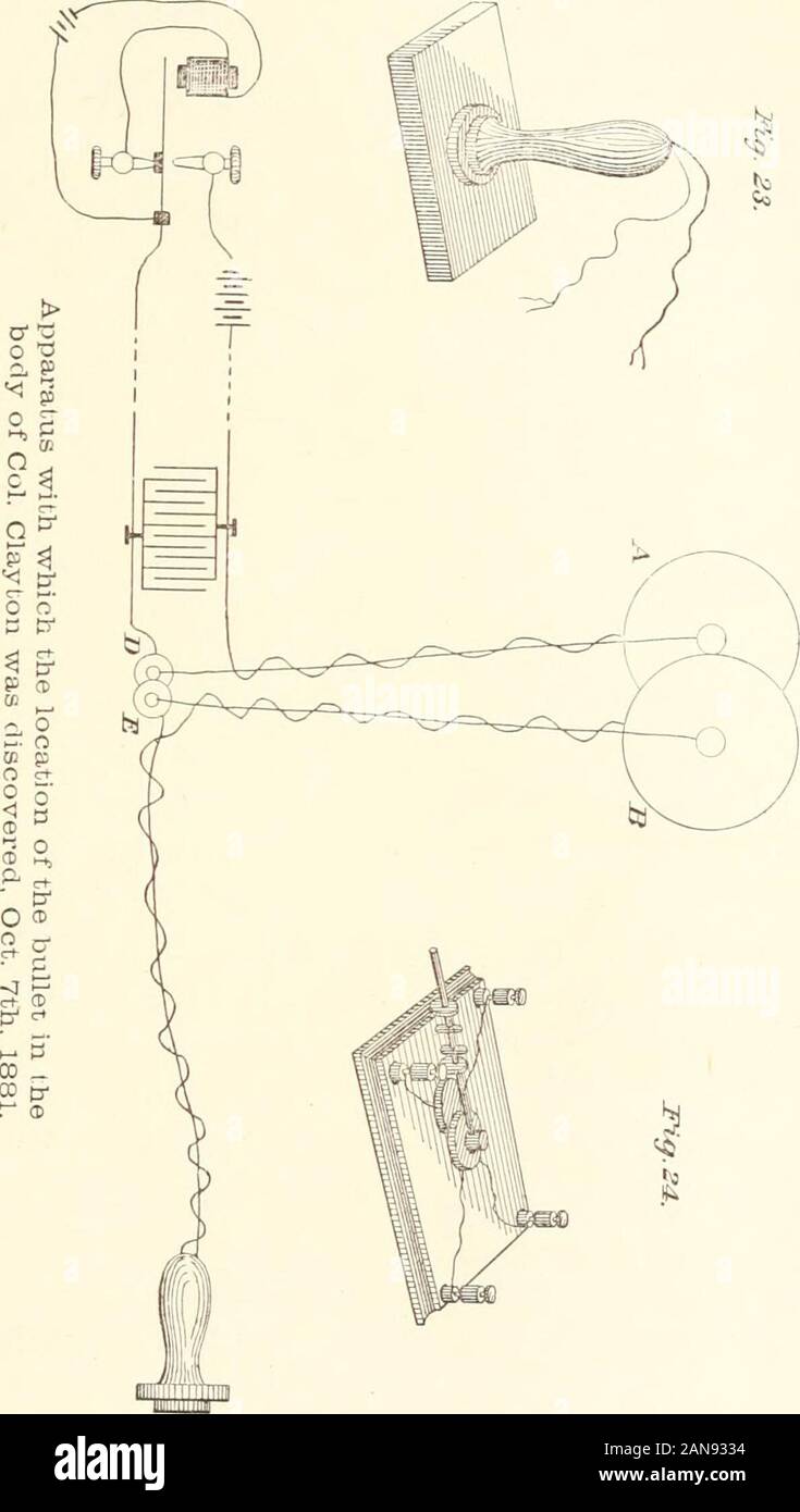 Upon the electrical experiments to determine the location of the bullet ...