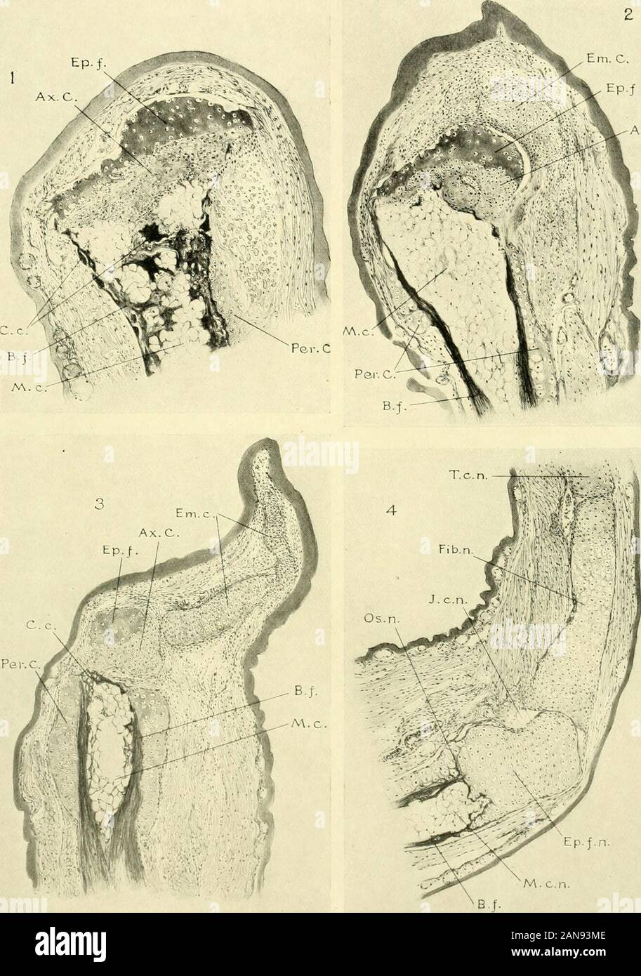 Longitudinal section of bone hi-res stock photography and images - Alamy