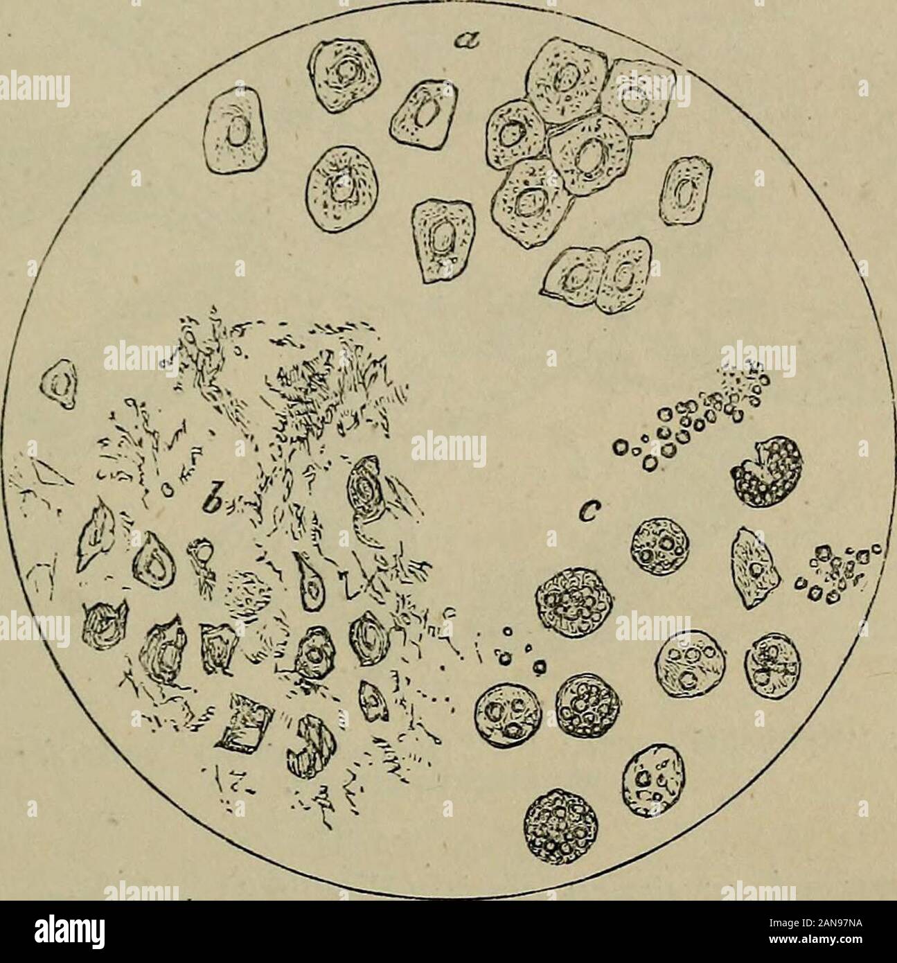 A practical treatise on urinary and renal diseases : including urinary ...
