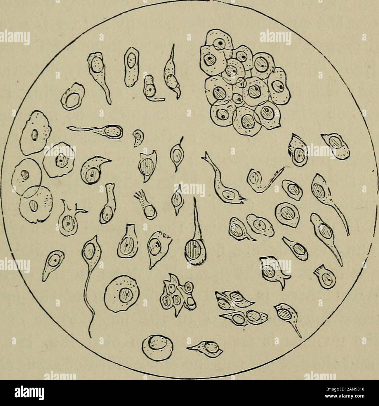 A practical treatise on urinary and renal diseases : including urinary ...