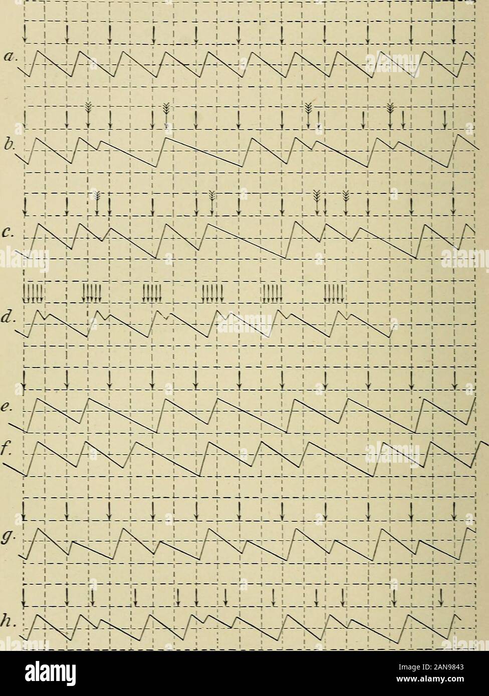 Bigeminus hi-res stock photography and images - Alamy