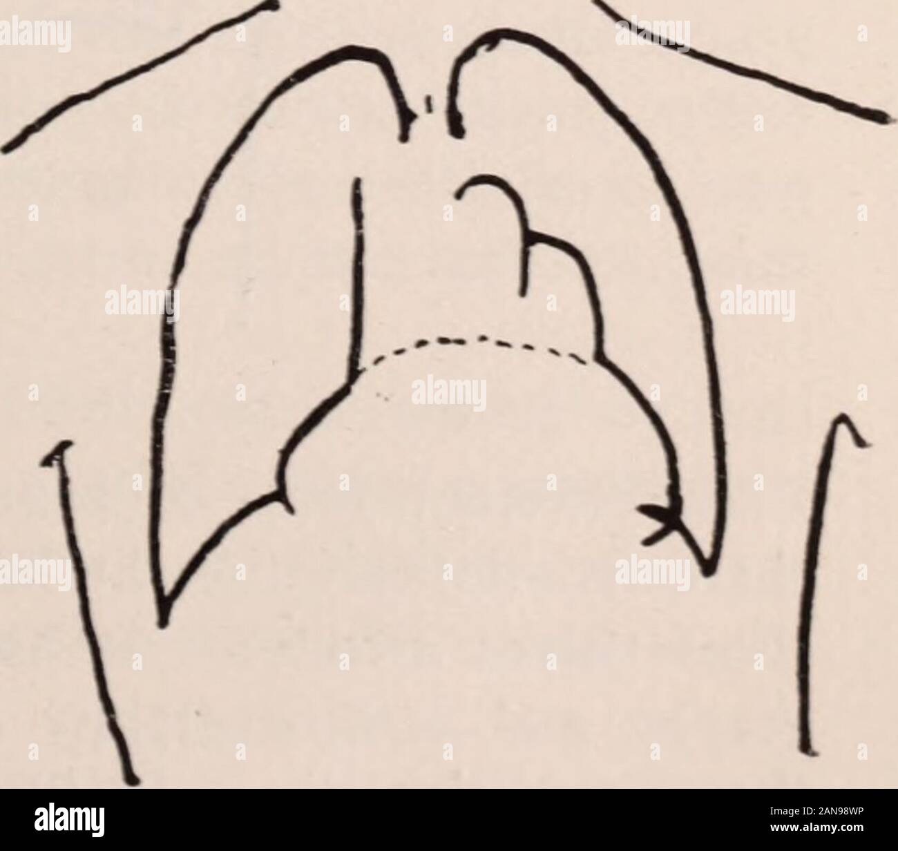 Ductus arteriosis hi-res stock photography and images - Alamy