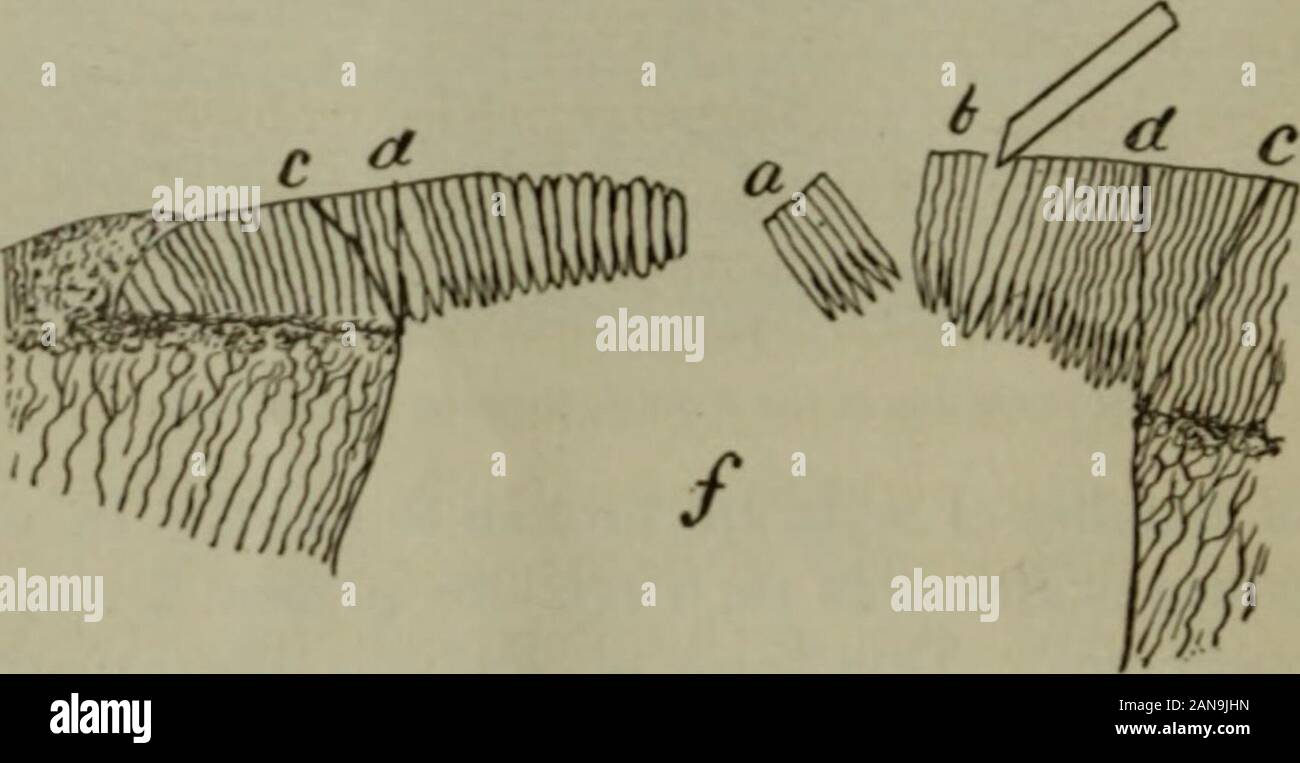 Enamel rods hi-res stock photography and images - Alamy
