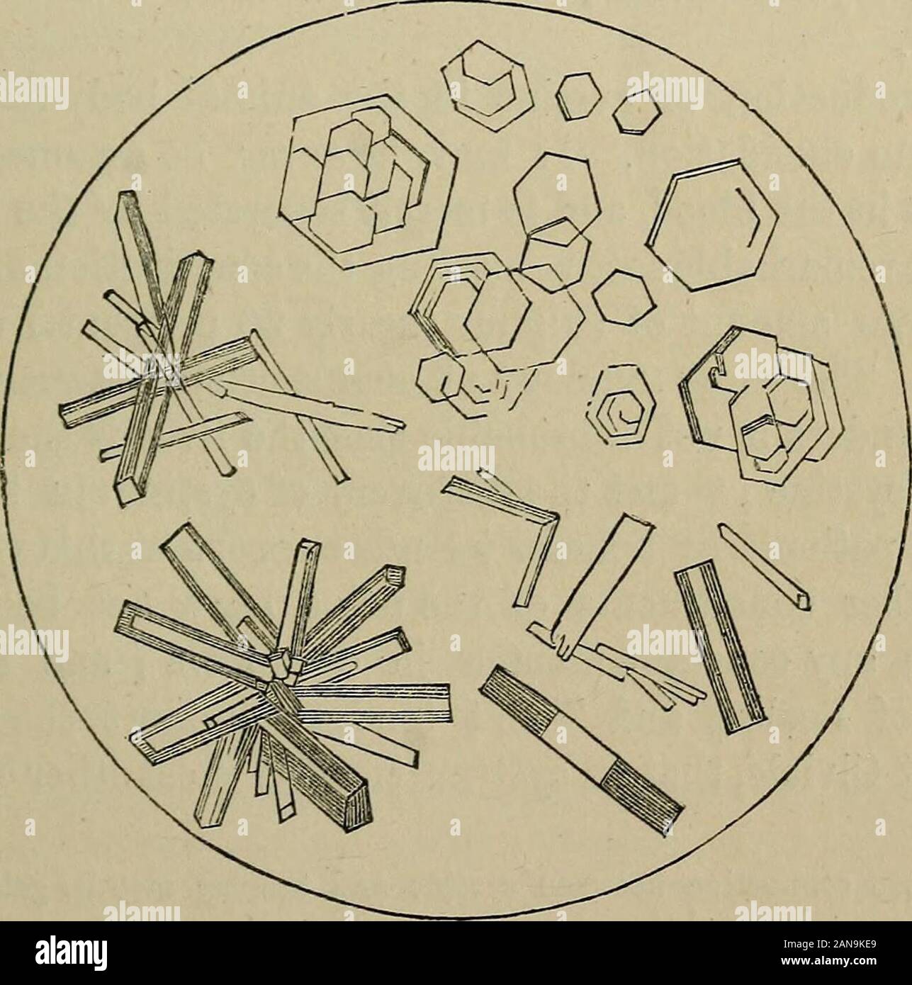 Cystine Crystals In Urine