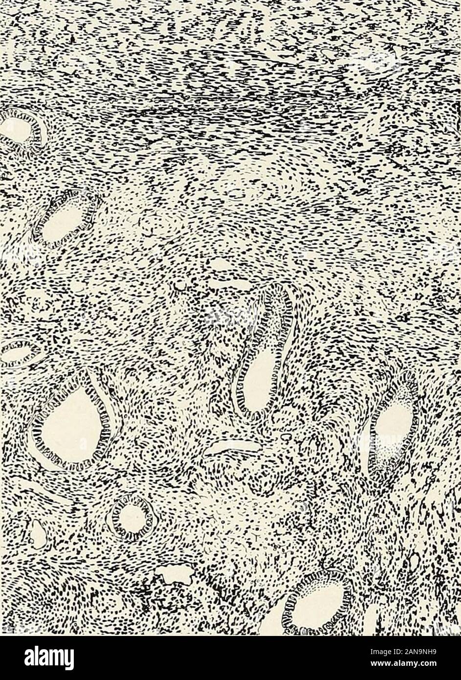 Gynaecology for students and practitioners . Fig. 10. The Endometrium ...