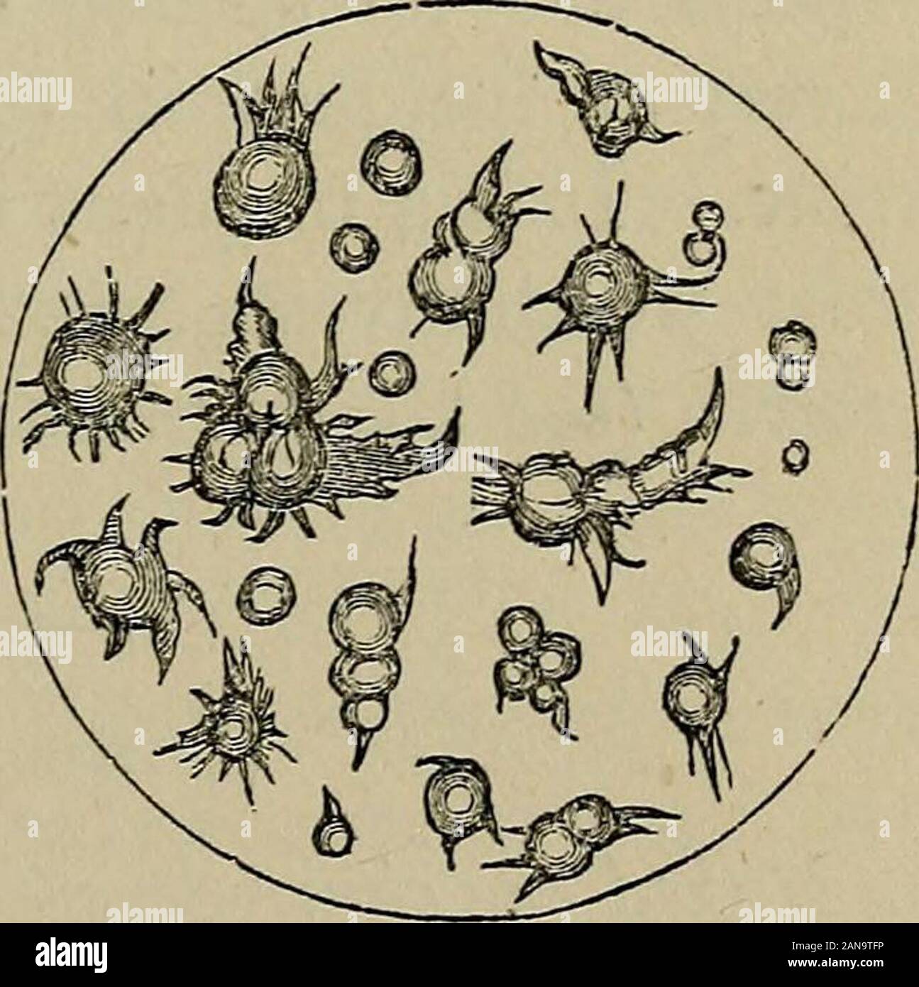 A practical treatise on urinary and renal diseases : including urinary ...
