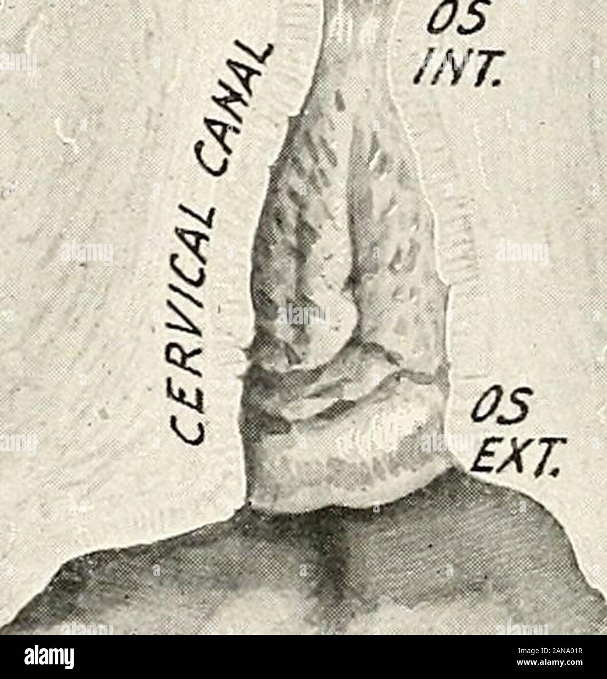 Gynaecology for students and practitioners . > w Stock Photo - Alamy