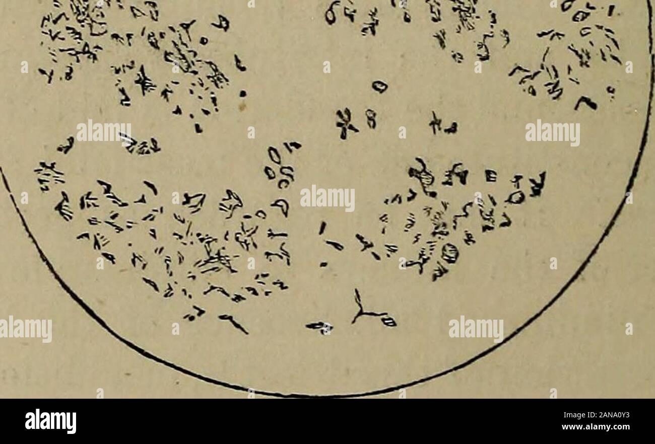 Amorphous Urate In Urine