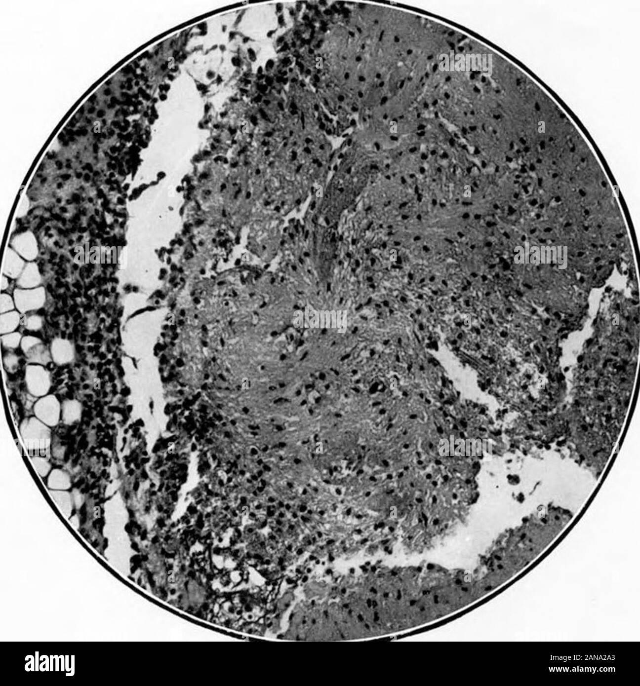 On the Action of Radium Rays upon the Cells of Jensen's Rat Sarcoma ...