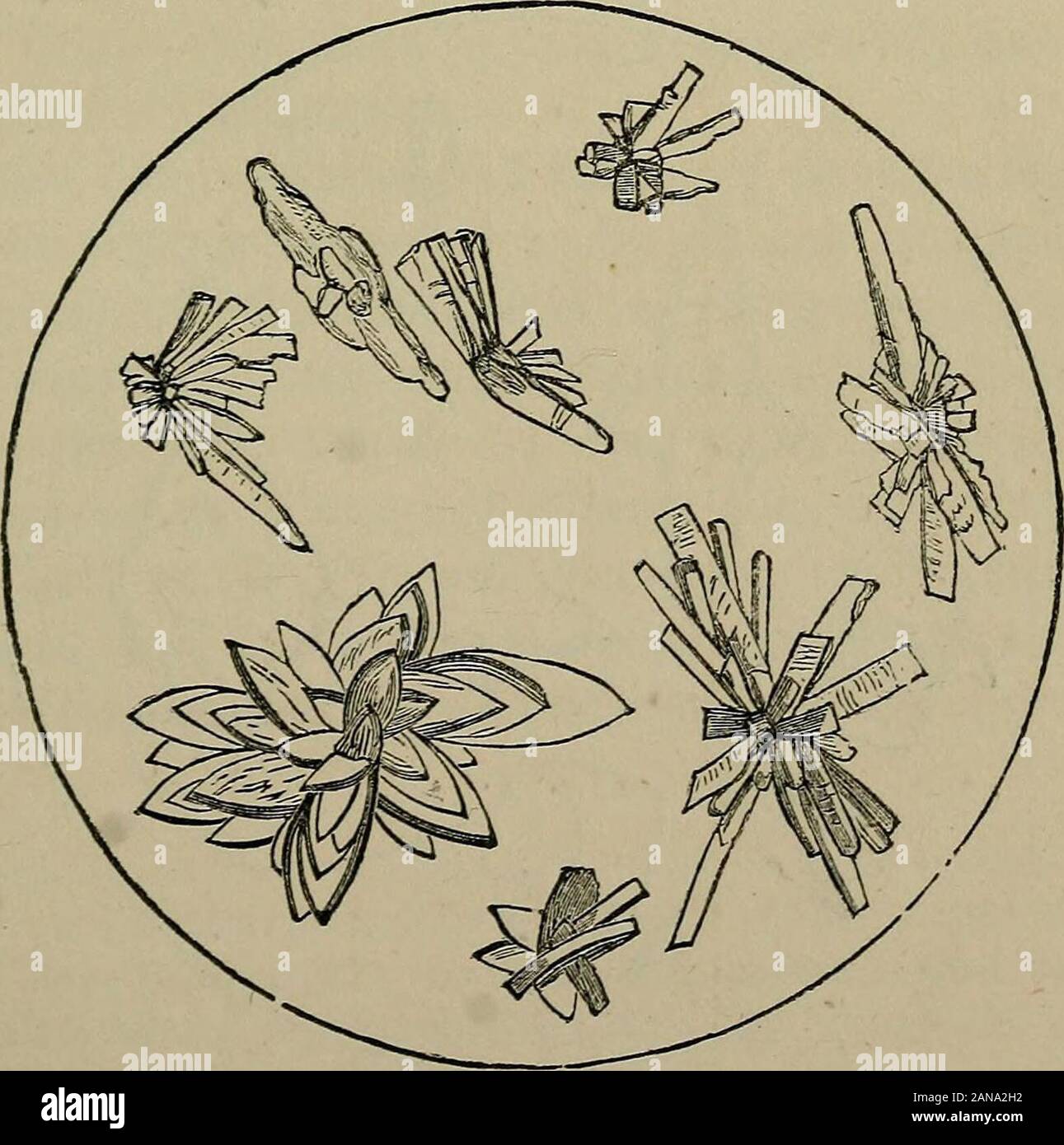 Uric acid crystals hi-res stock photography and images - Alamy