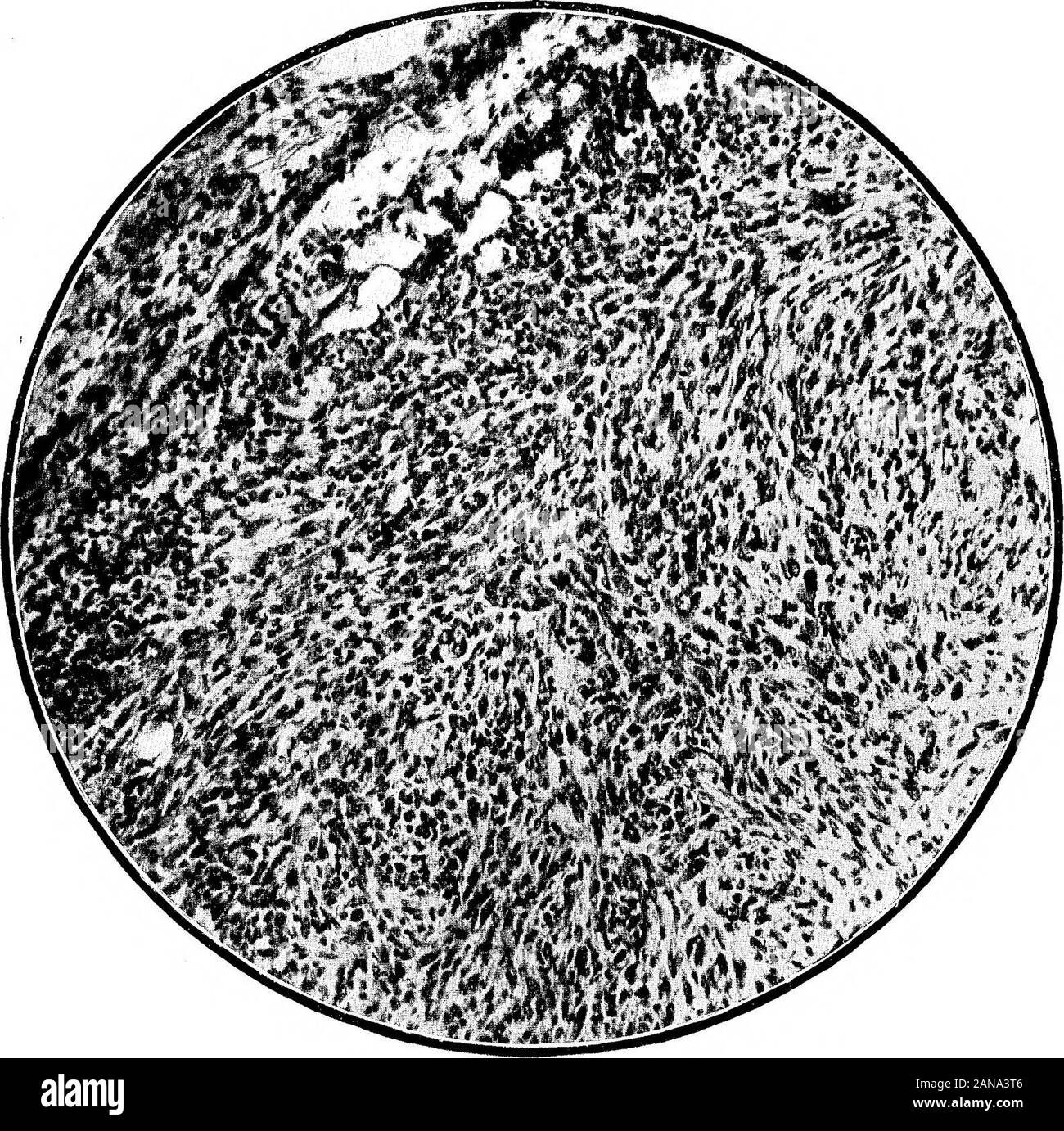 On the Action of Radium Rays upon the Cells of Jensen's Rat Sarcoma . 3 ...