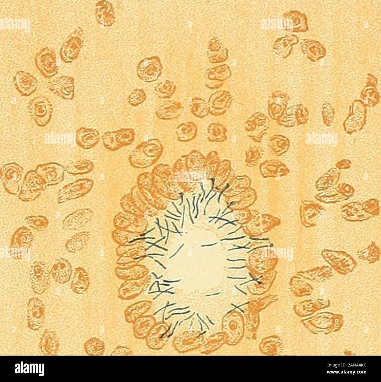 Granulation tissue wound hi-res stock photography and images - Alamy