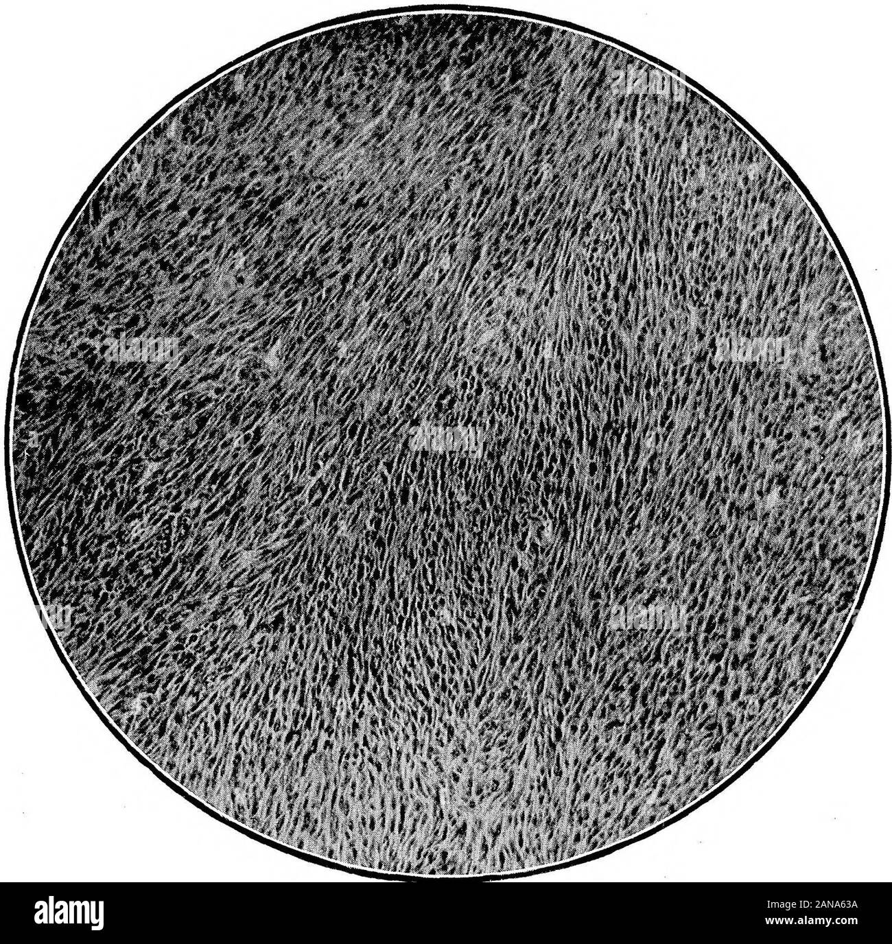 On the Action of Radium Rays upon the Cells of Jensen's Rat Sarcoma . 1 ...