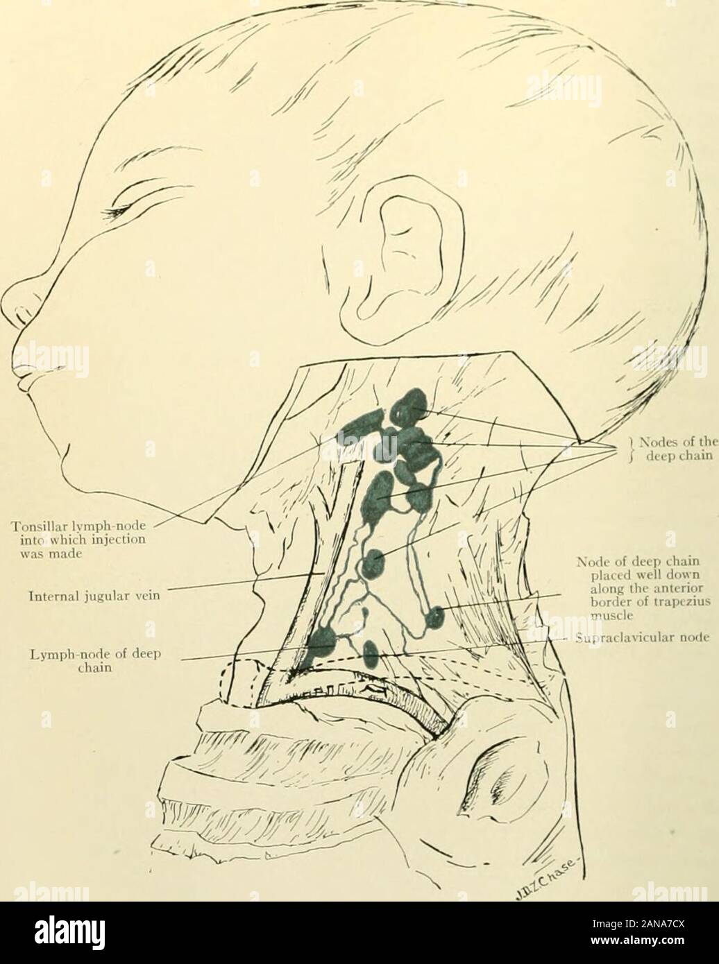 Supraclavicular Lymph Nodes