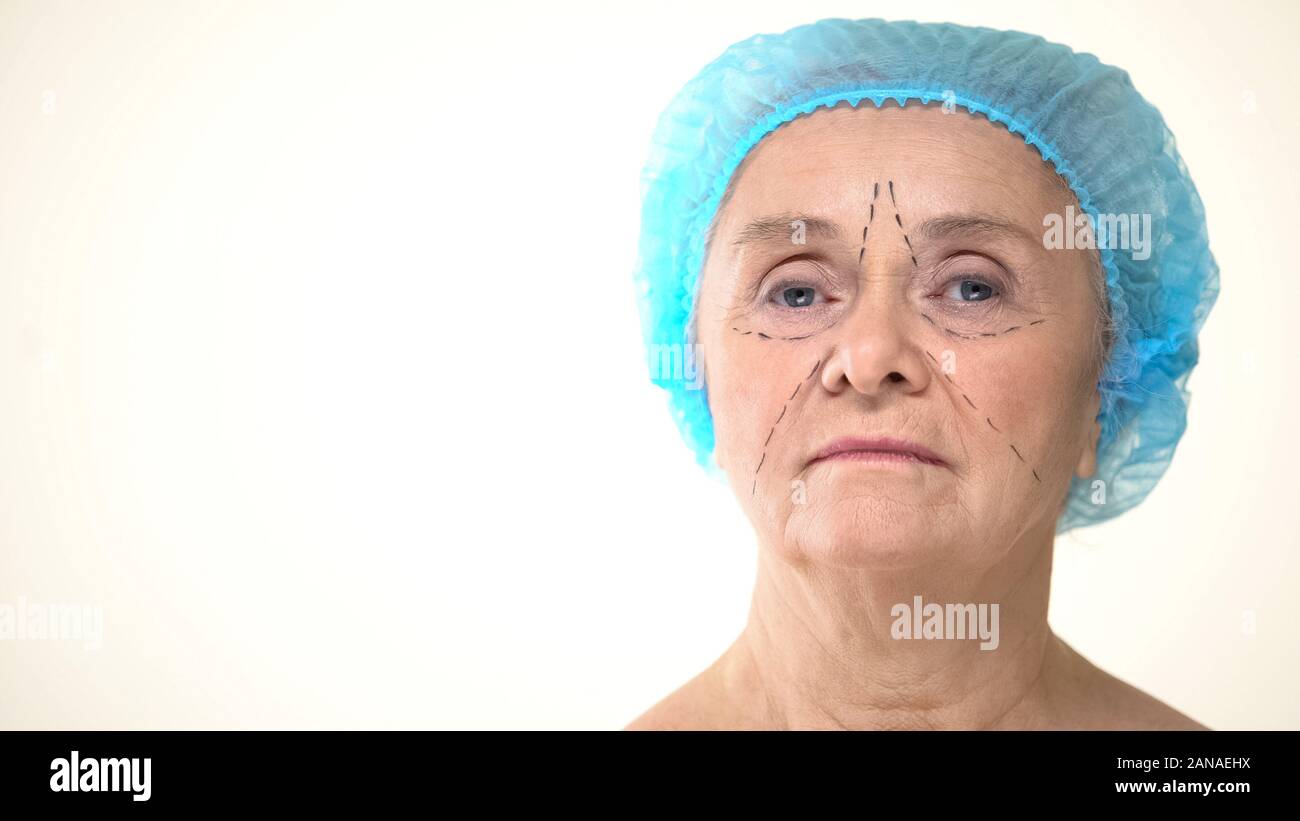 Portrait of old female with marks on face before plastic surgery ...