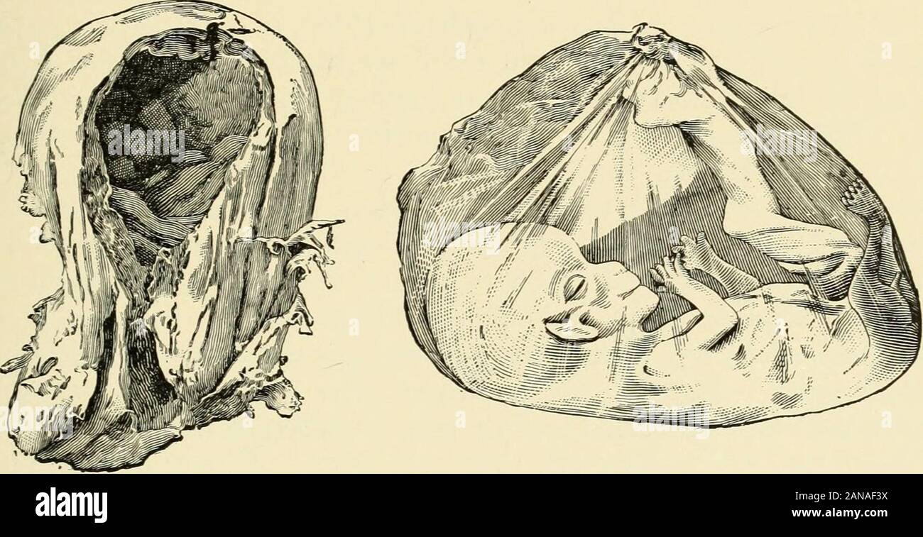 Placenta formation hi-res stock photography and images - Alamy