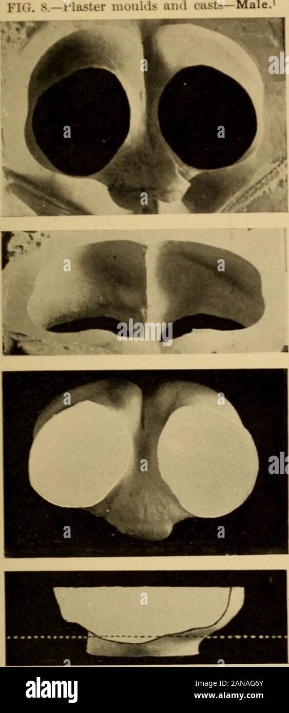 Perinea hi-res stock photography and images - Alamy
