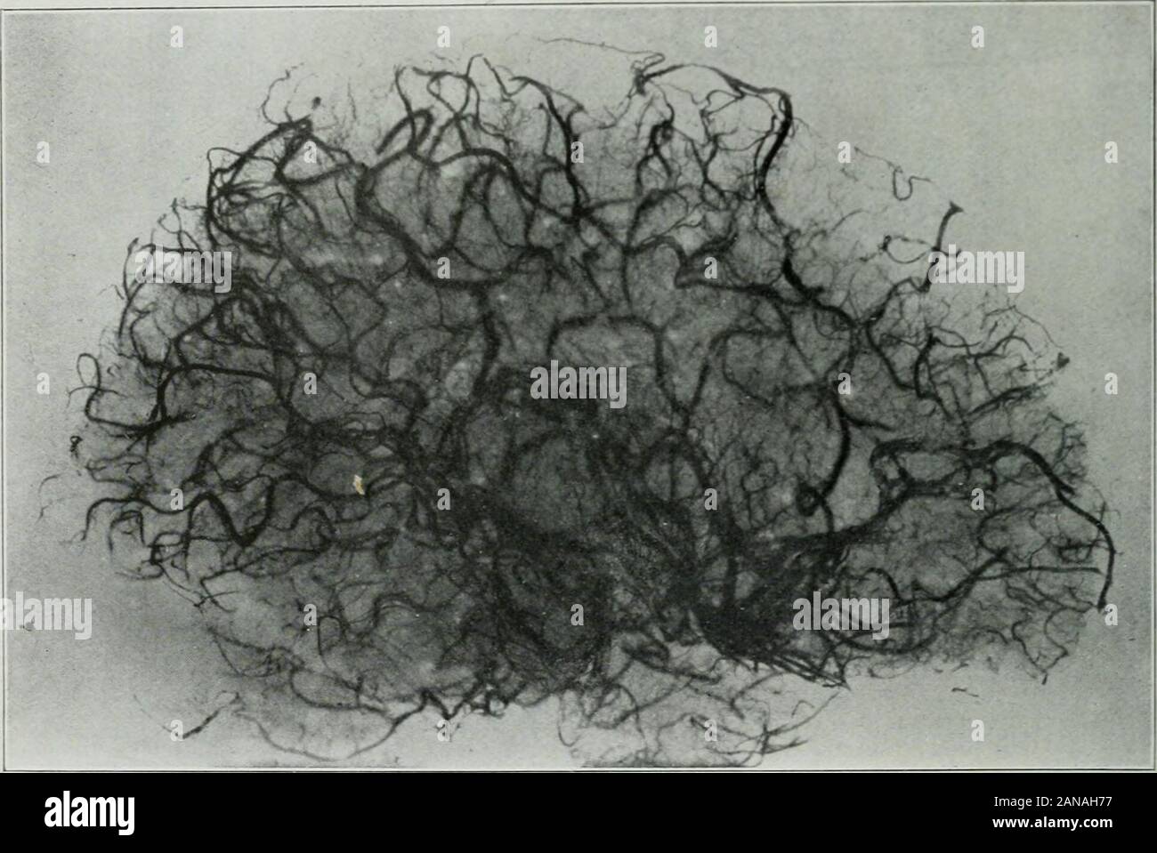 The Journal of laboratory and clinical medicine . ximum resistance was ...