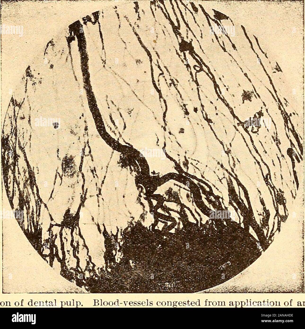 Principles and practice of operative dentistry . mol is used for its ...