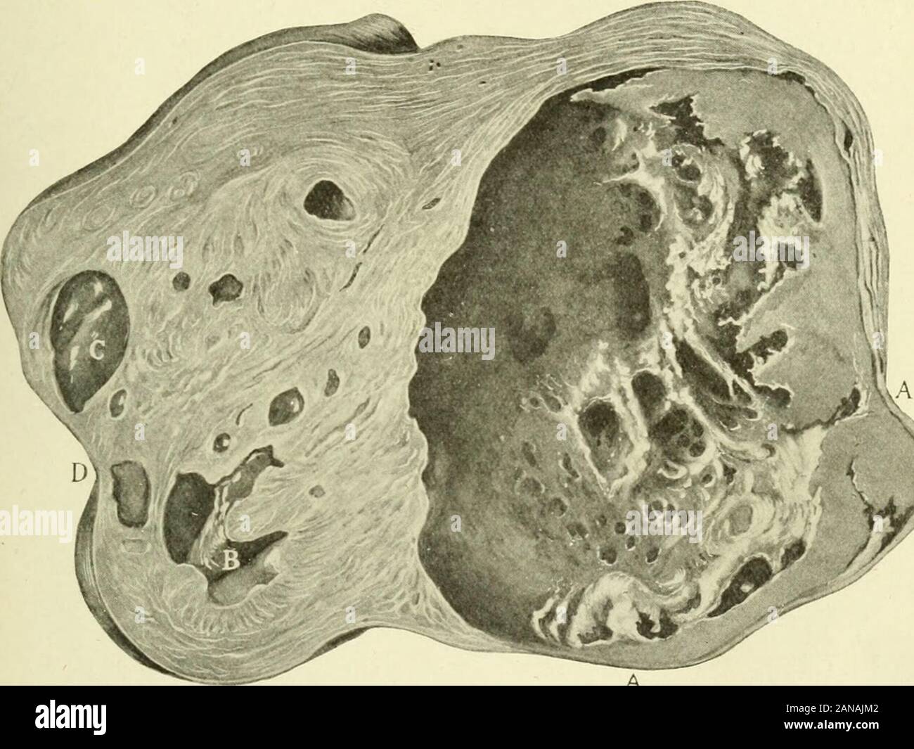 Tic blood hi-res stock photography and images - Alamy