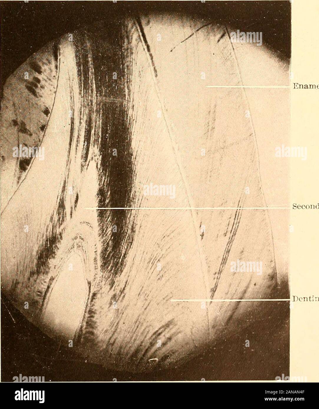 Principles and practice of operative dentistry . Fig. 510.—Vertical ...