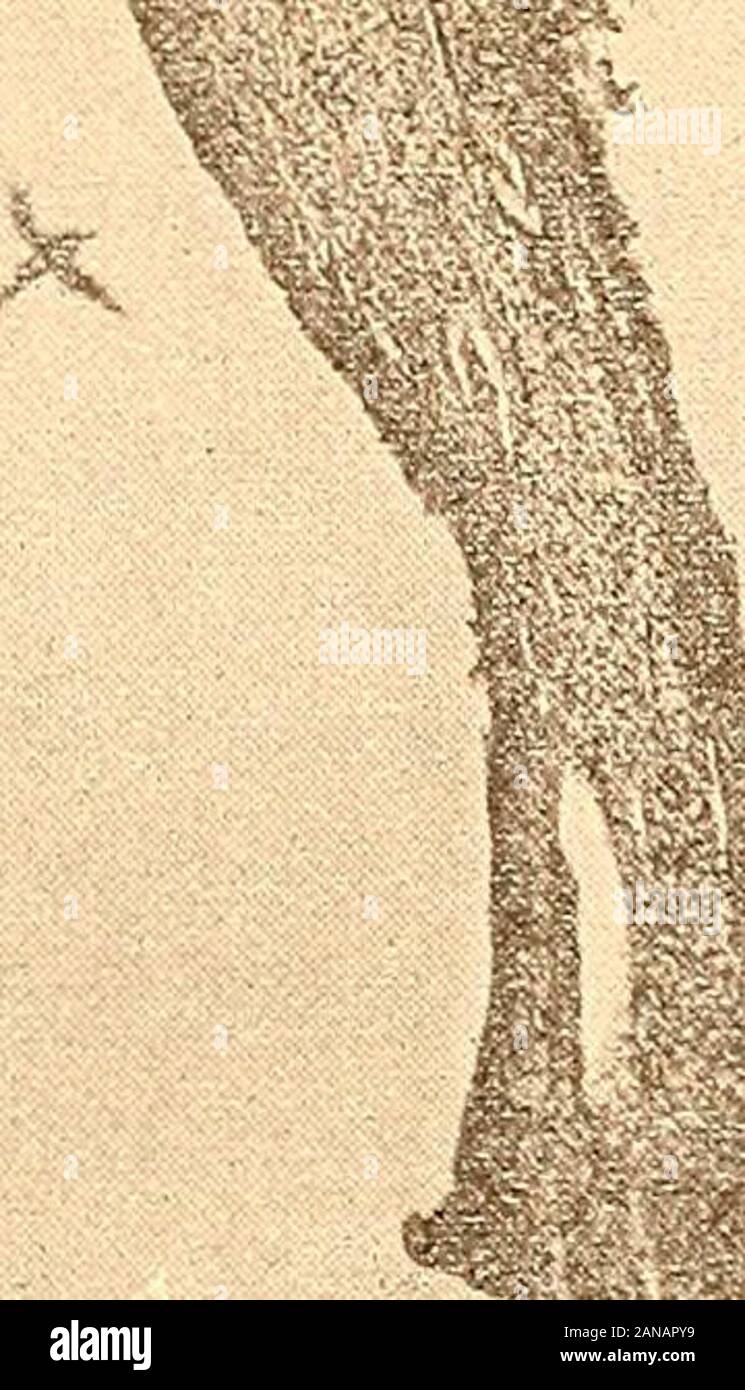 Symptomatology hi-res stock photography and images - Alamy