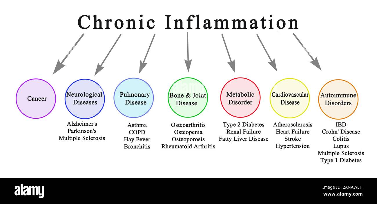 Seven Consequences of Chronic Inflammation Stock Photo - Alamy