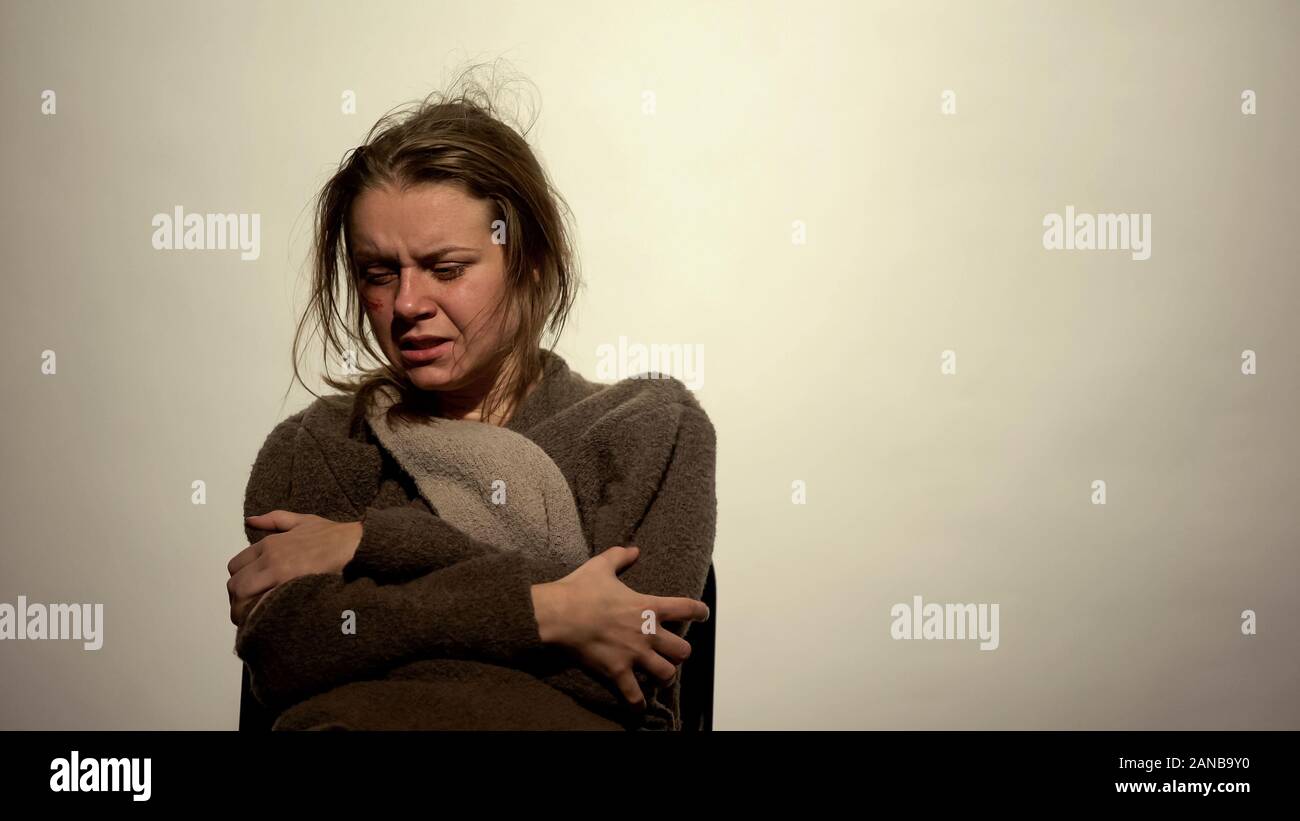 Face bruise hi-res stock photography and images - Alamy