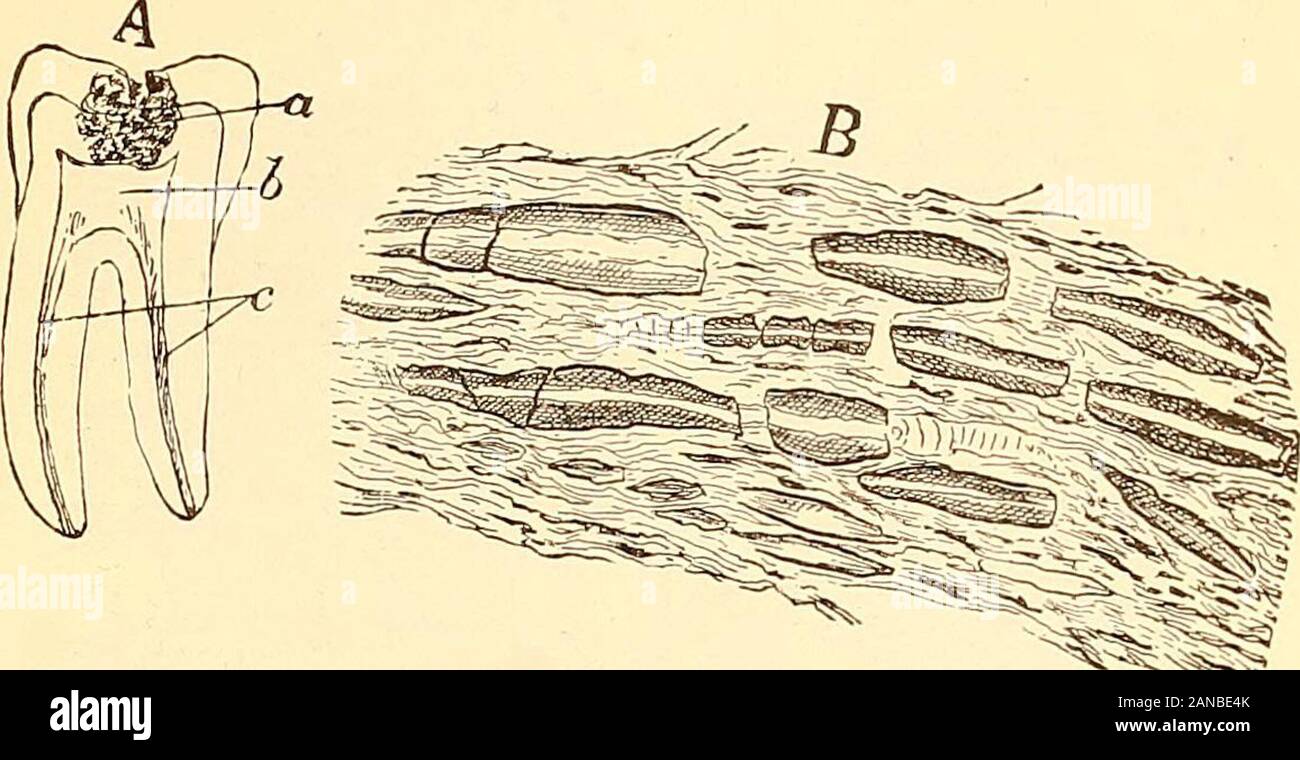 Principles and practice of operative dentistry . Fig. 4l>3.—Section of ...