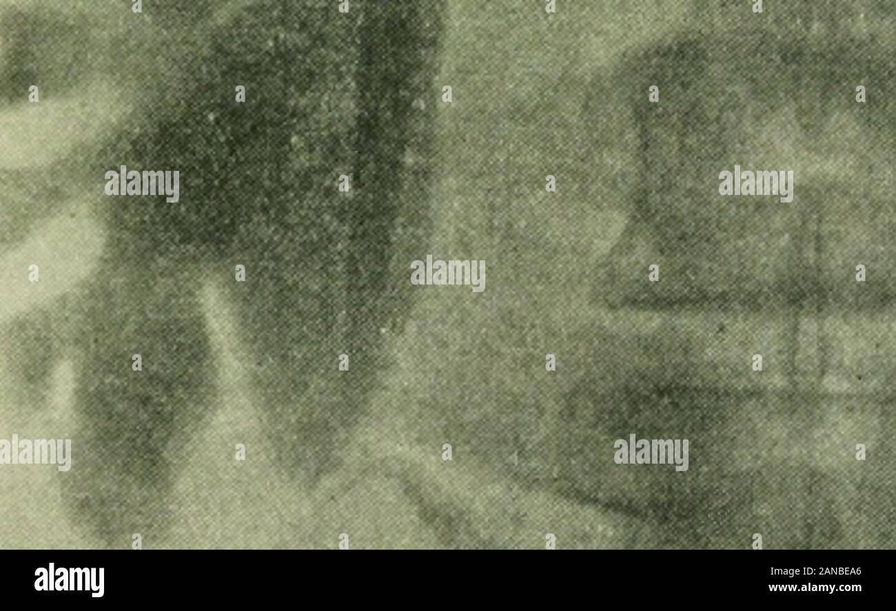 Skiagraphy hi-res stock photography and images - Alamy