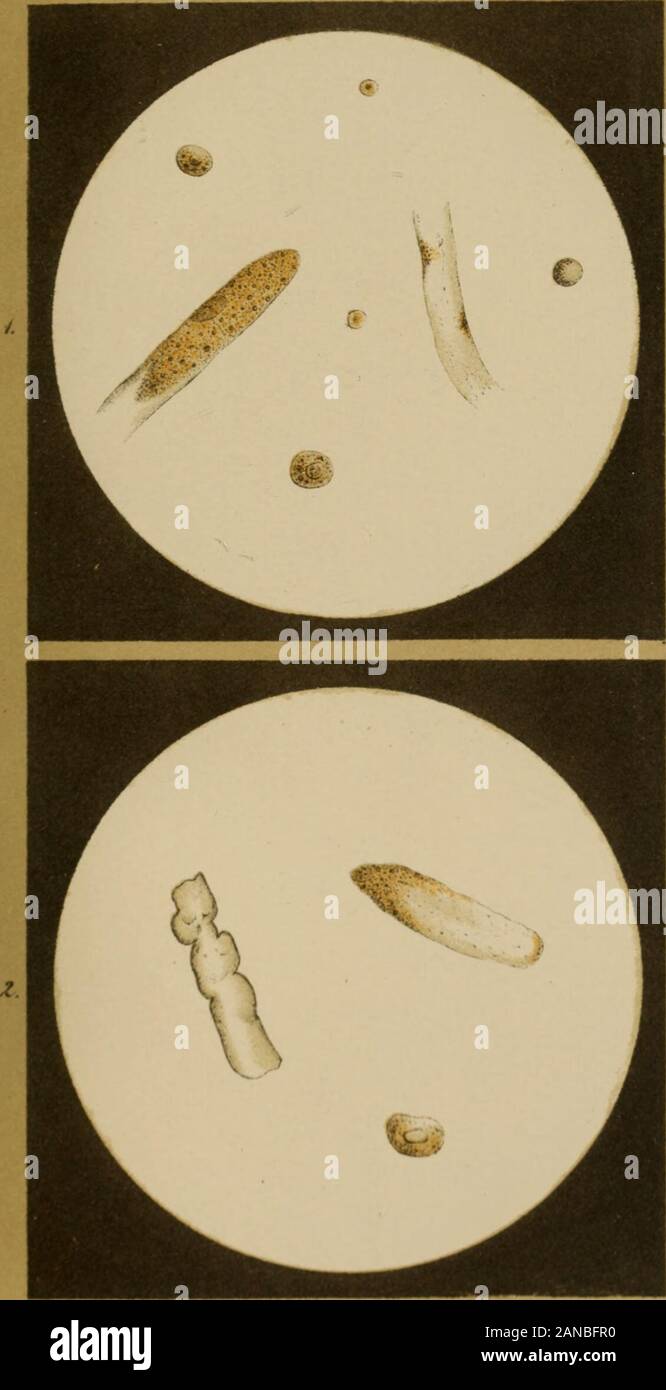 Pyelitis hi-res stock photography and images - Alamy