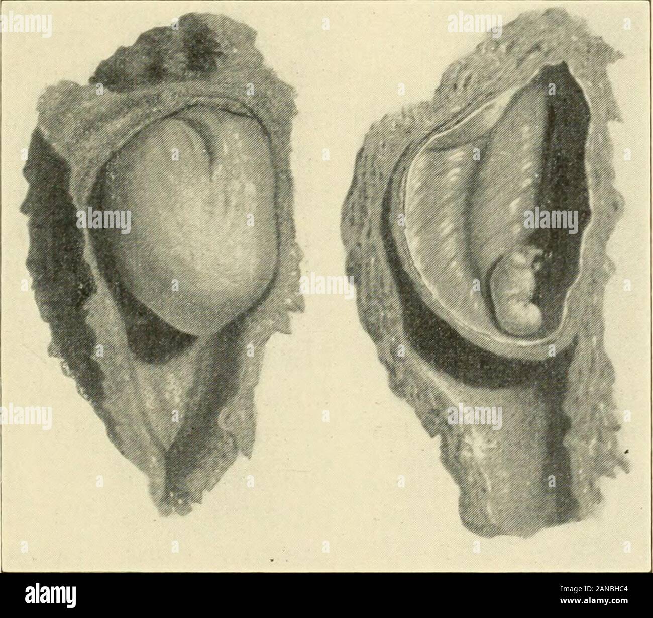 Uterine muscle hi-res stock photography and images - Alamy