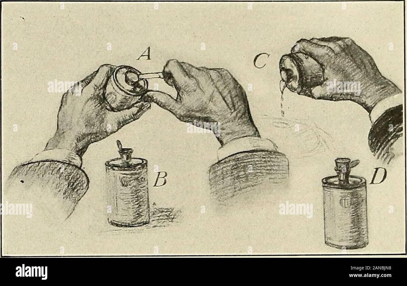 Anesthesia . c acid. ADMINISTRATION OF ETHER The Open or Drop Method ...