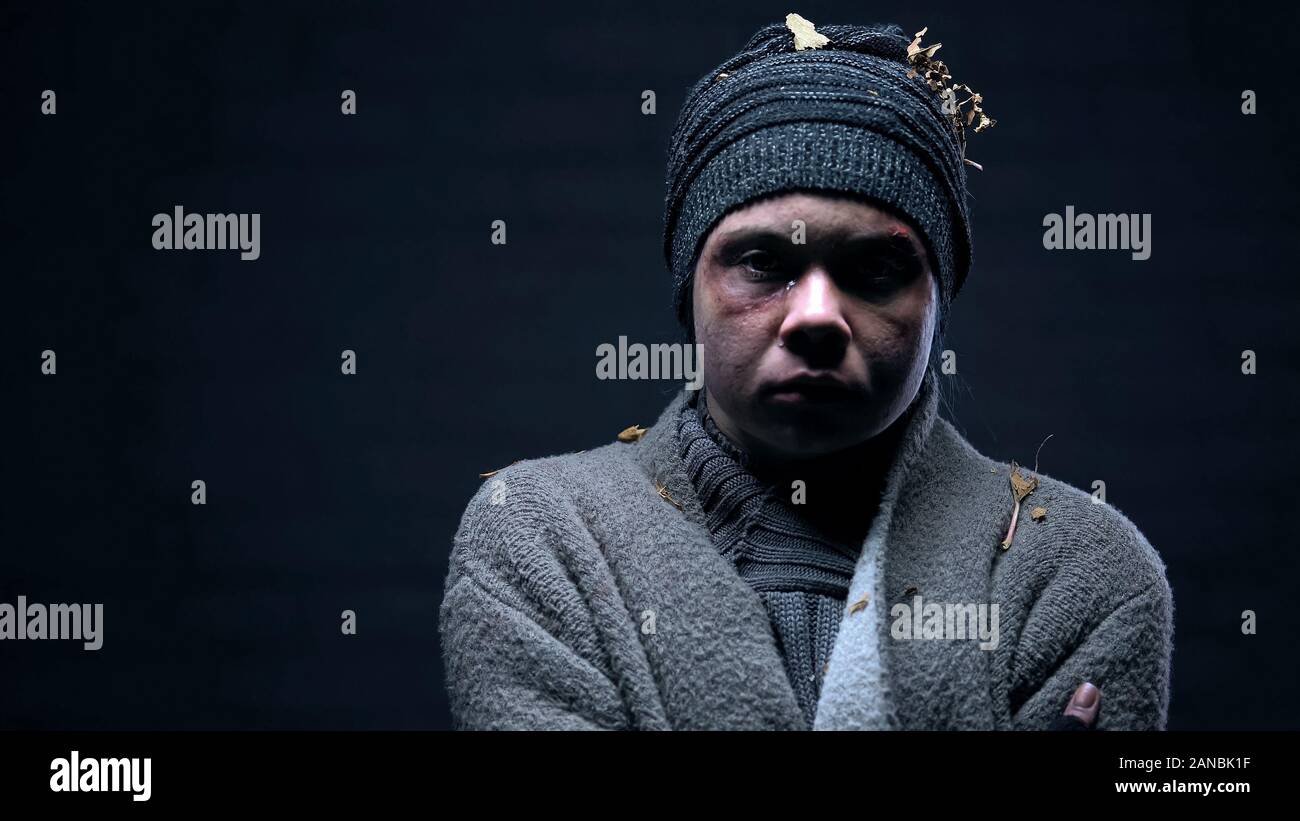 Crying injured homeless person looking camera, feeling scared, violence ...