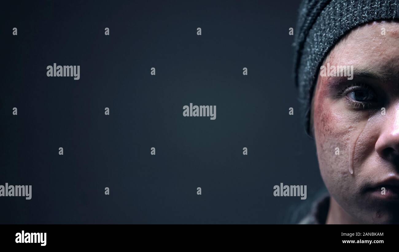 Half-face of injured crying person on dark background, cruelty and ...