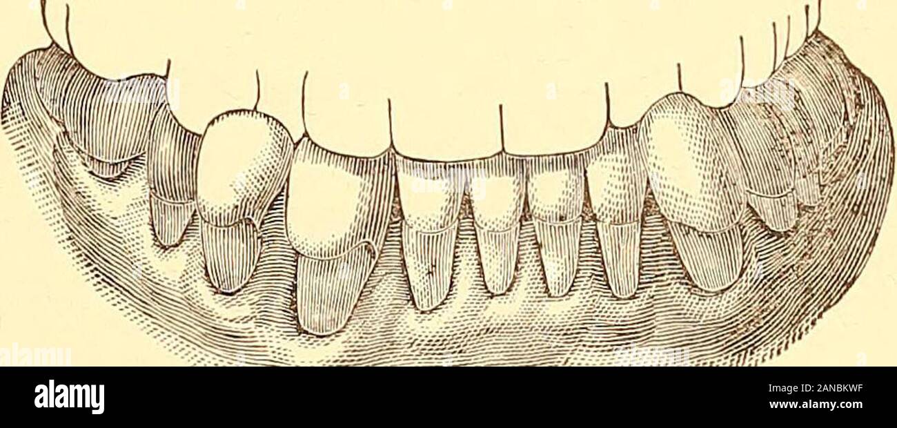 Chewing tobacco teeth hi-res stock photography and images - Alamy