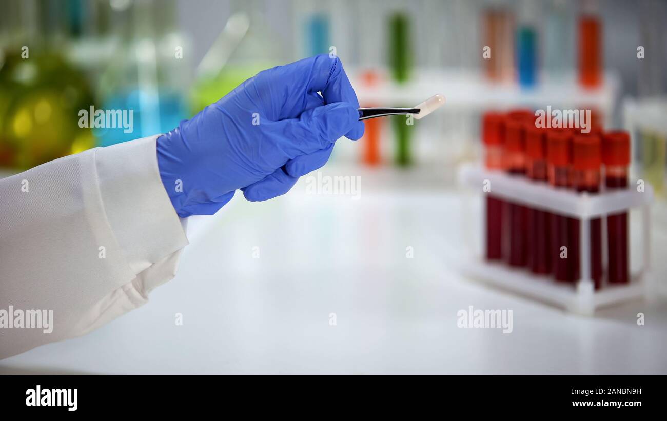 Blood samples and test tubes with colored liquid standing on table of ...