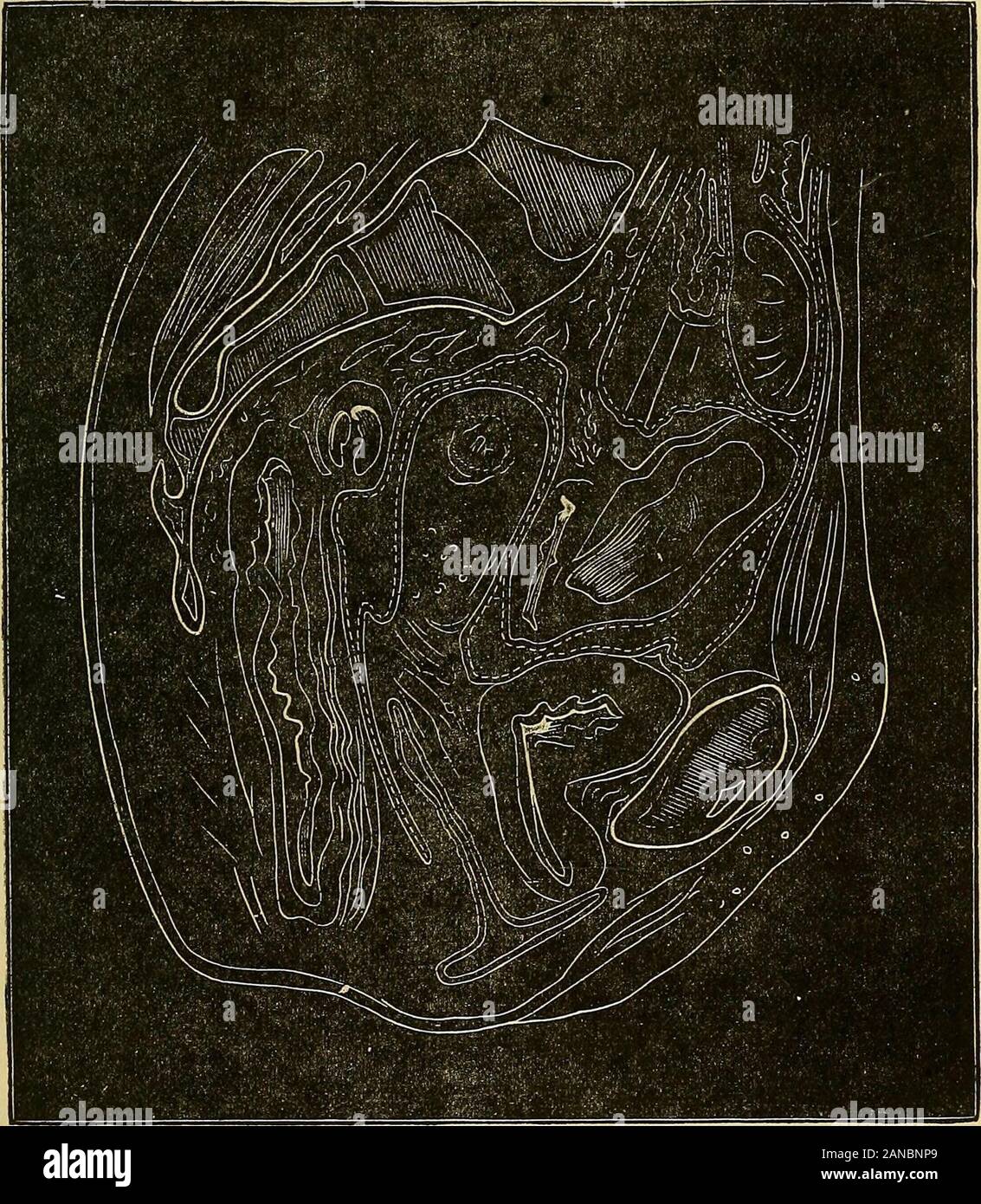 Manual of gynecology . , 41). This descent of the peritoneum behind the ...