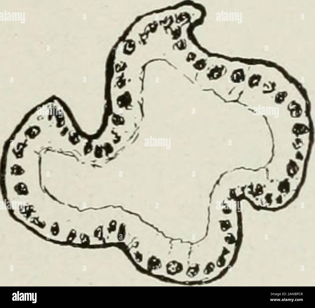 Archives of internal medicine . Fig. 4.—Diagrammatic sketeli of iKnuial ...