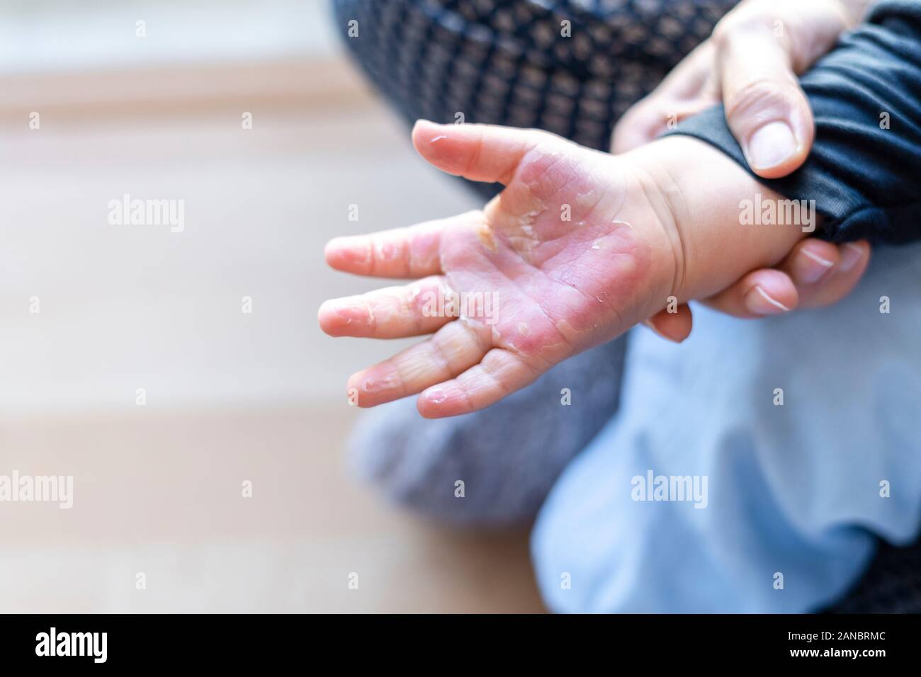Mother boy hurt arm hi-res stock photography and images - Alamy