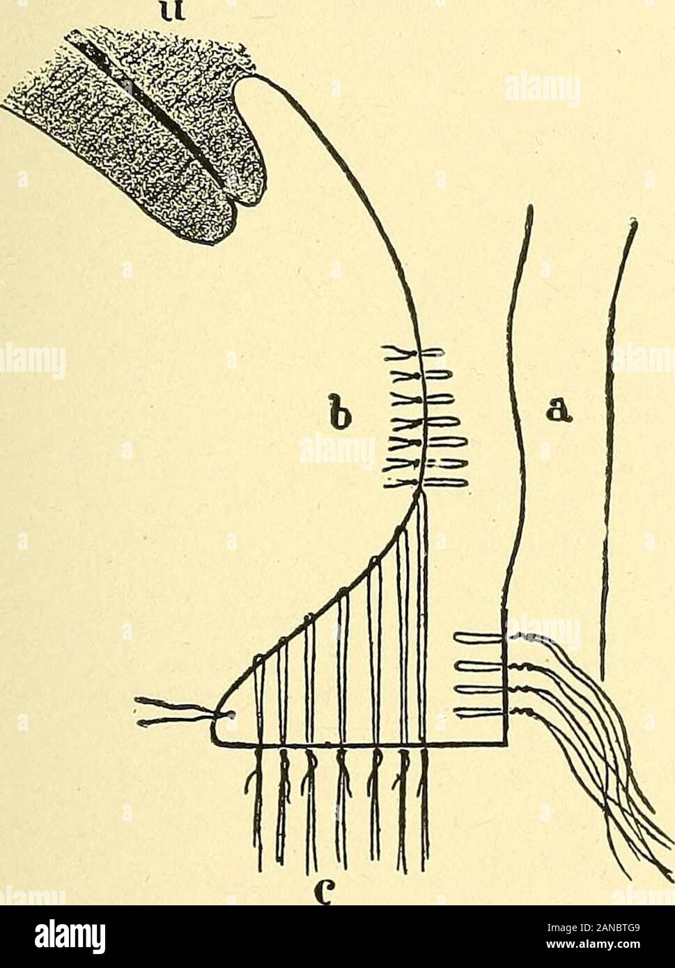Treatise on gynaecology : medical and surgical . 114. Lauensteim^s ...