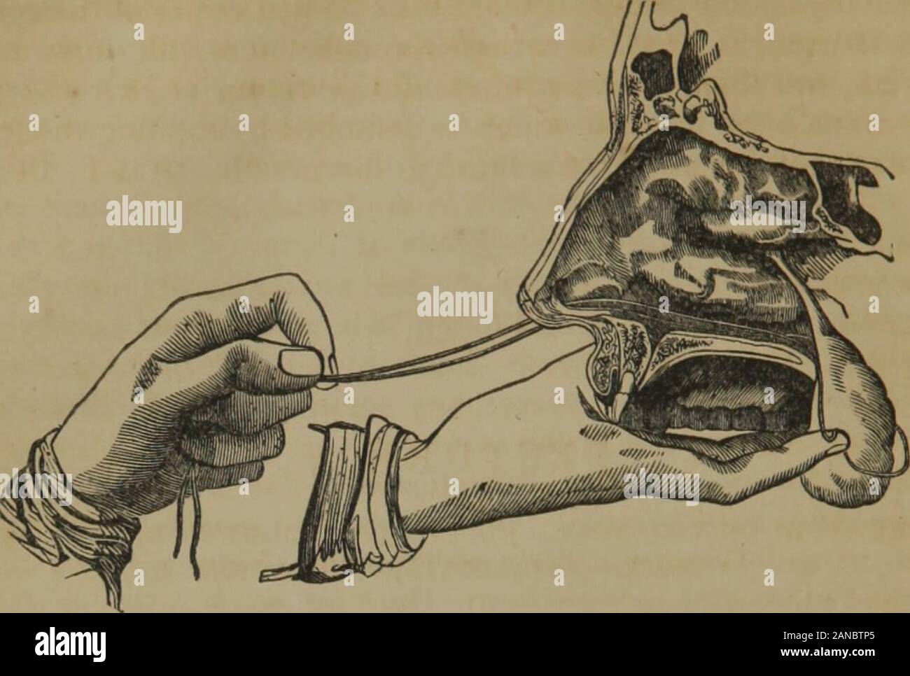 Impending suffocation hi-res stock photography and images - Alamy
