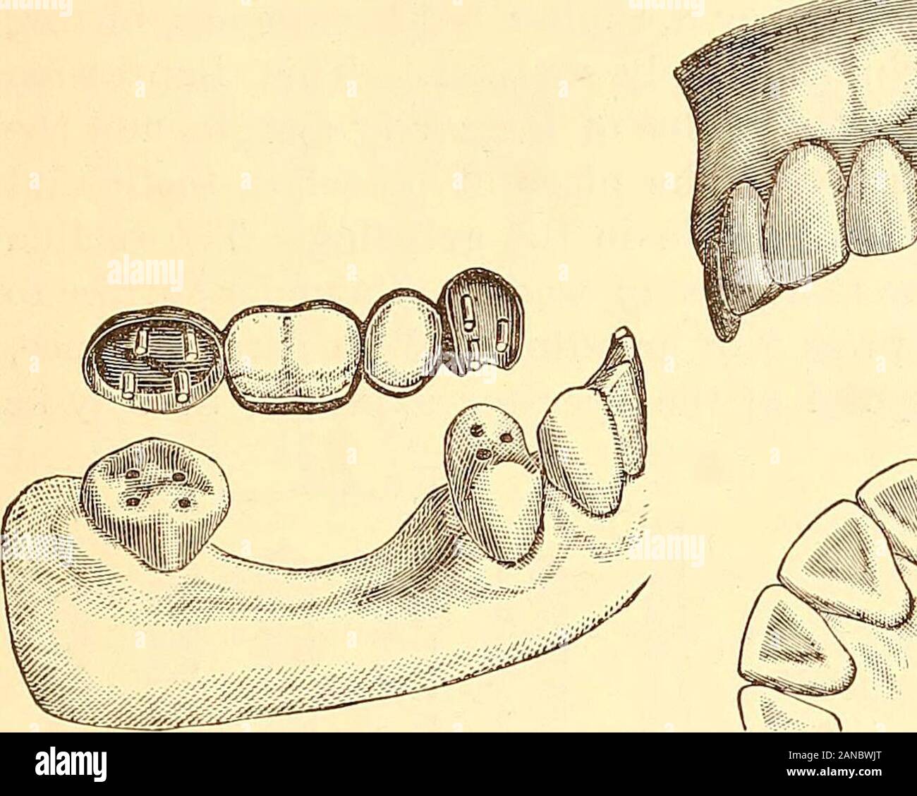 Principles and practice of operative dentistry . Front and back views ...