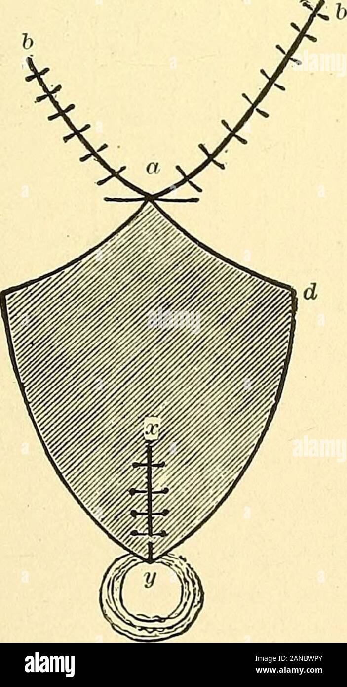 Labia majora hi-res stock photography and images - Alamy