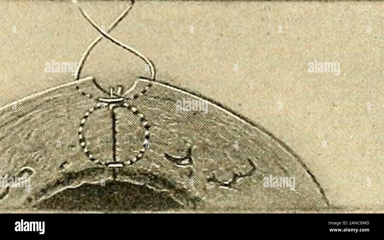 Cesarean section . s this advantage of distinctly minor importance ...