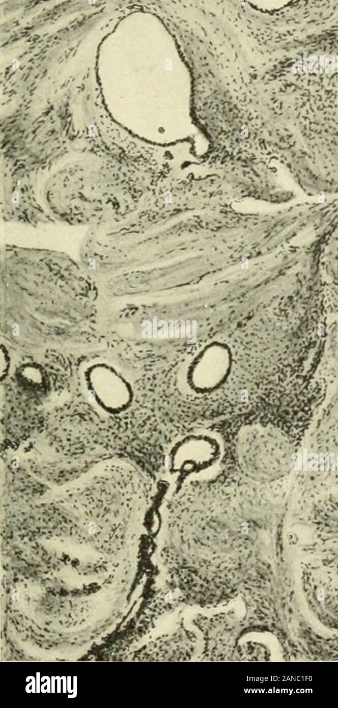 Round ligament of uterus hi-res stock photography and images - Alamy