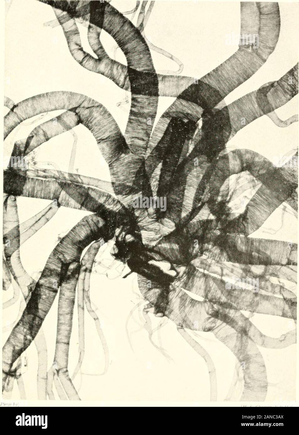Spiracles insect hi-res stock photography and images - Alamy